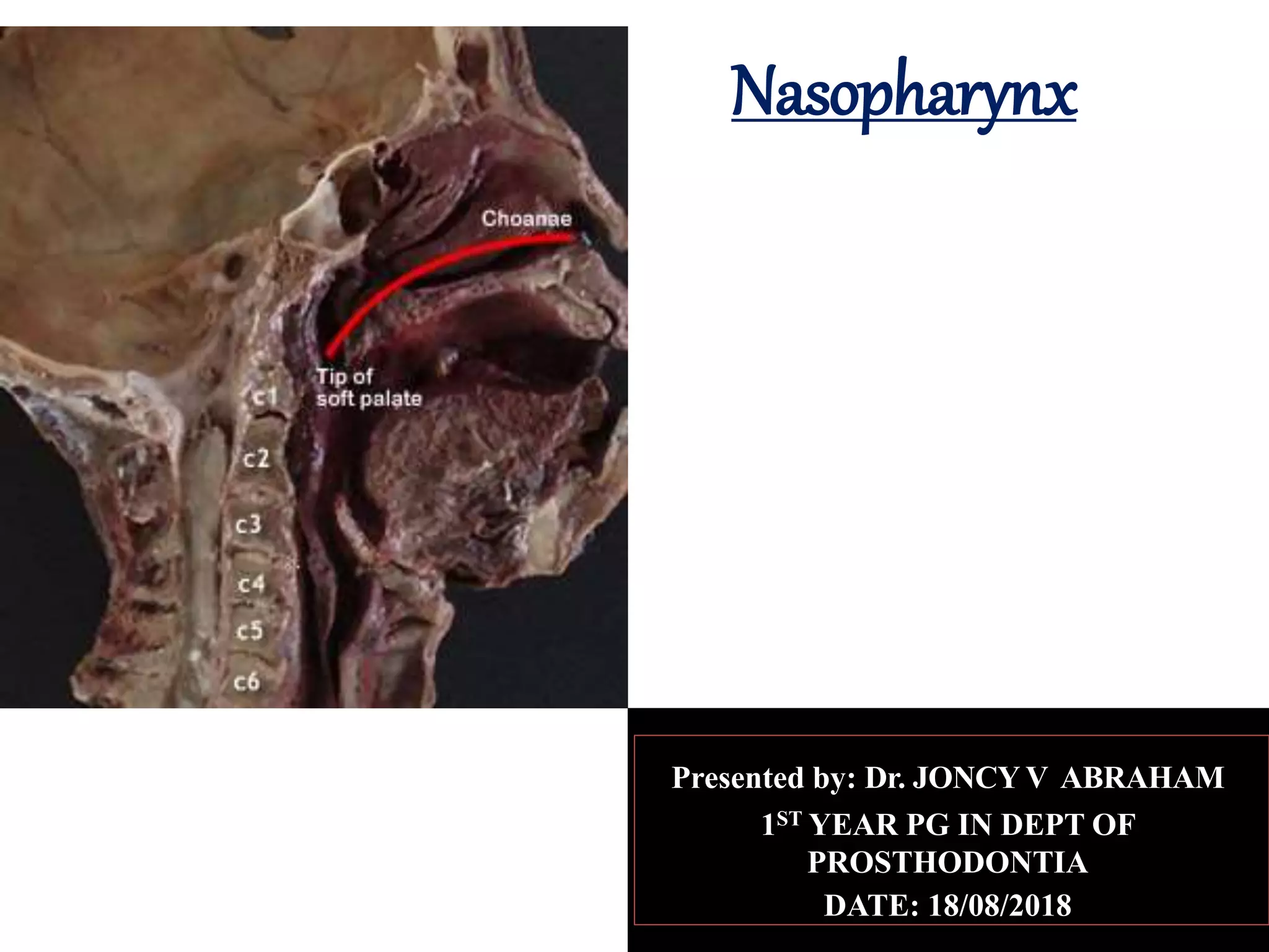 Nasopharynx gross anatomy and applied anatomy in dental and medical ...
