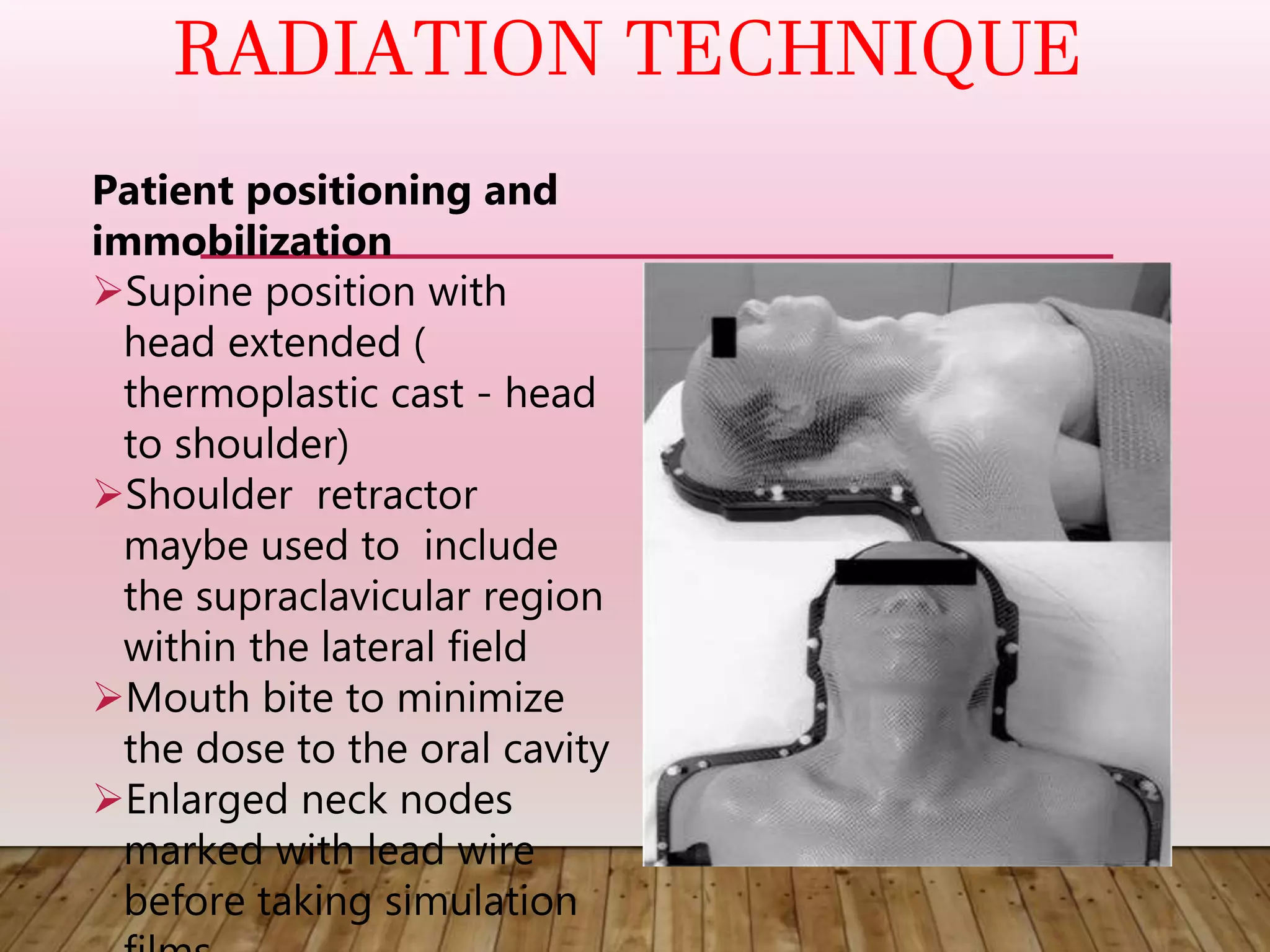 Nasopharynx rt techniques | PPTX