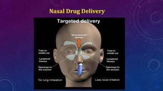 Nasopulmonary Drug Delivery System | PDF
