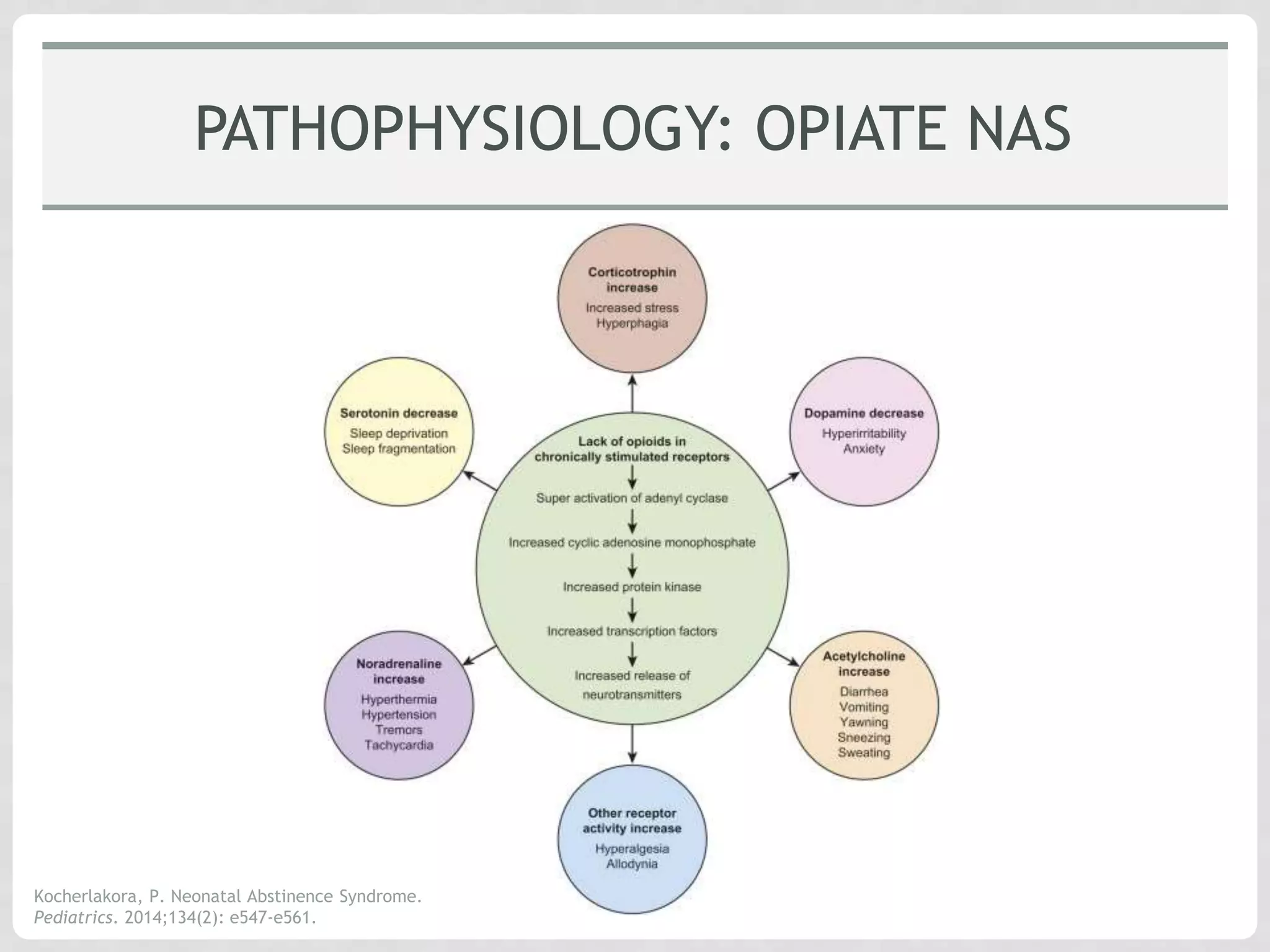 Neonatal Abstinence Syndrome | PPTX