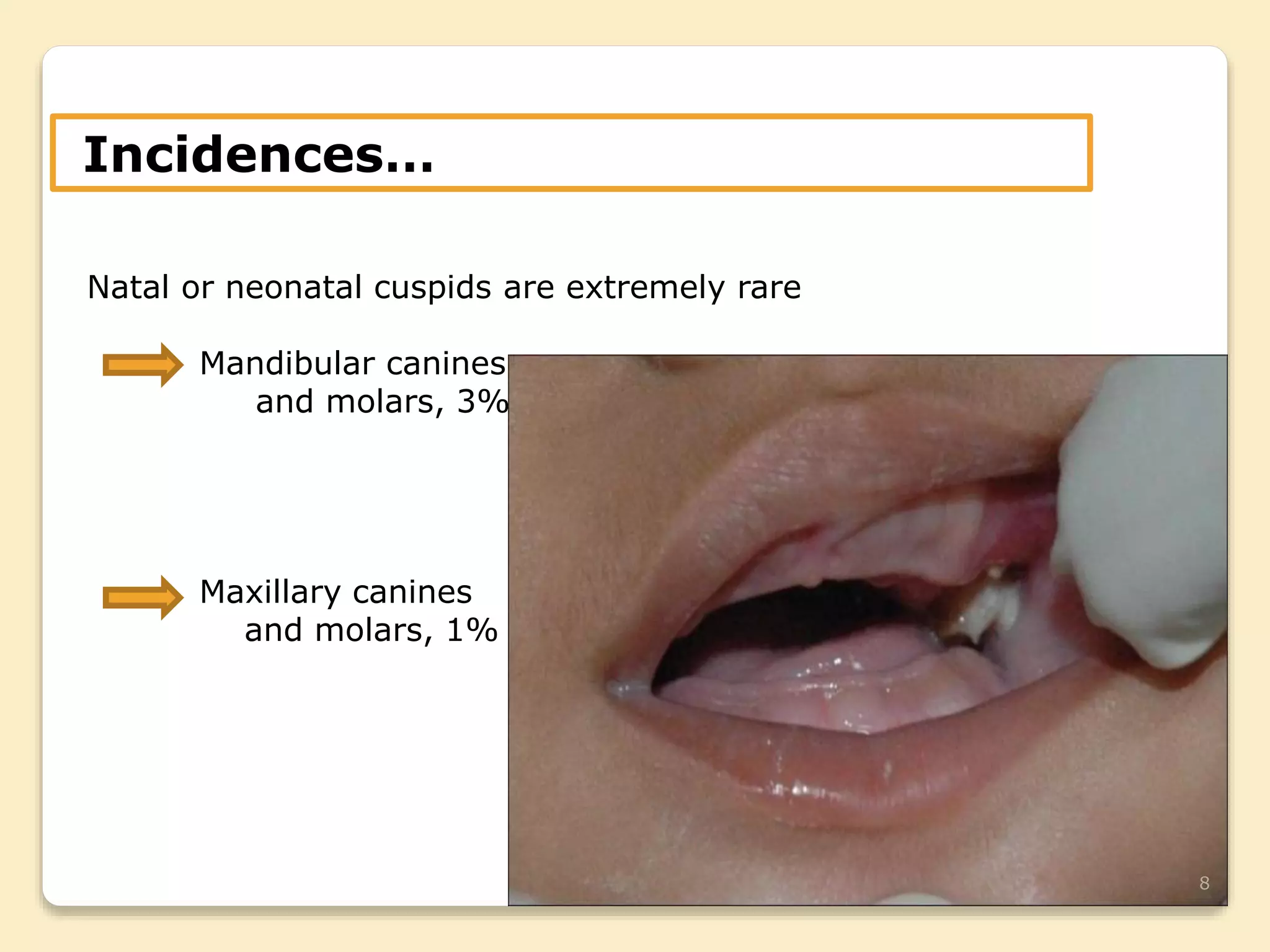 Natal and neonatal teeth | PPTX