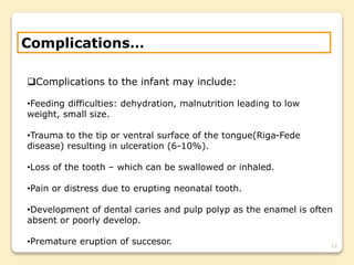 Natal and neonatal teeth | PPTX
