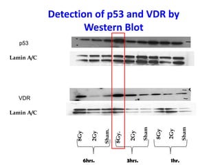 The Role of Vitamin D in Breast Cancer | PPTX