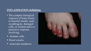 INFLAMMATION,types,morphological patterns,acute inflammation,chronic ...