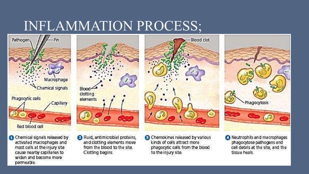 INFLAMMATION,types,morphological patterns,acute inflammation,chronic ...
