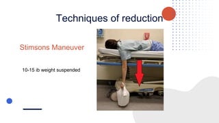 Upper extremity fractures.pptx