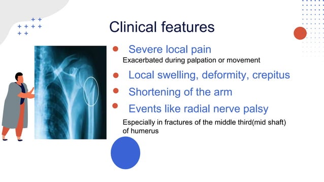 Upper extremity fractures.pptx