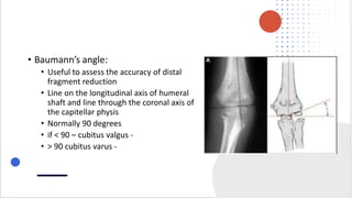 Upper extremity fractures.pptx | Death, Injury, or Military Conflict ...
