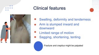 Upper extremity fractures.pptx | Death, Injury, or Military Conflict ...