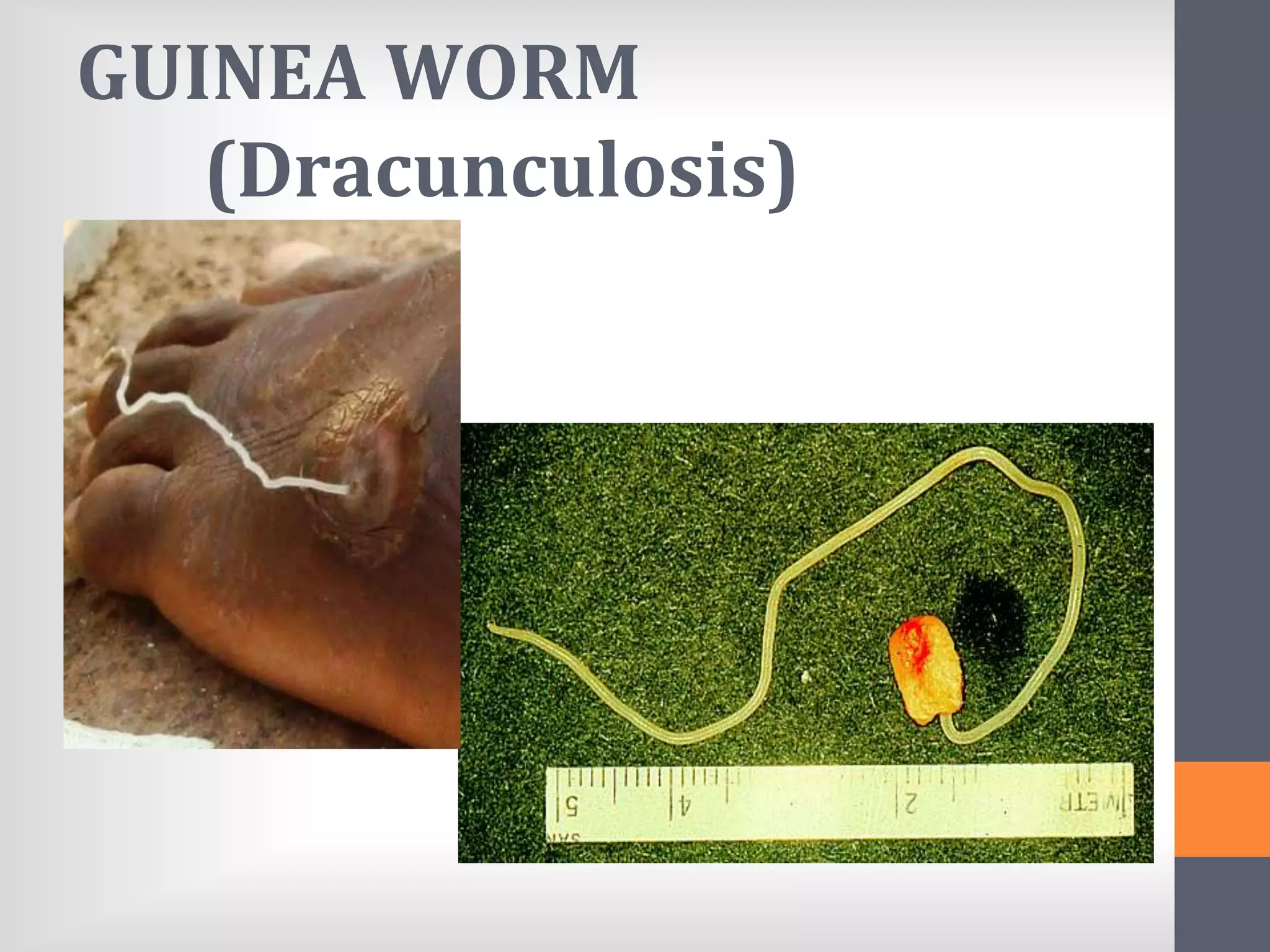 National guinea worm disease control programme | PPT