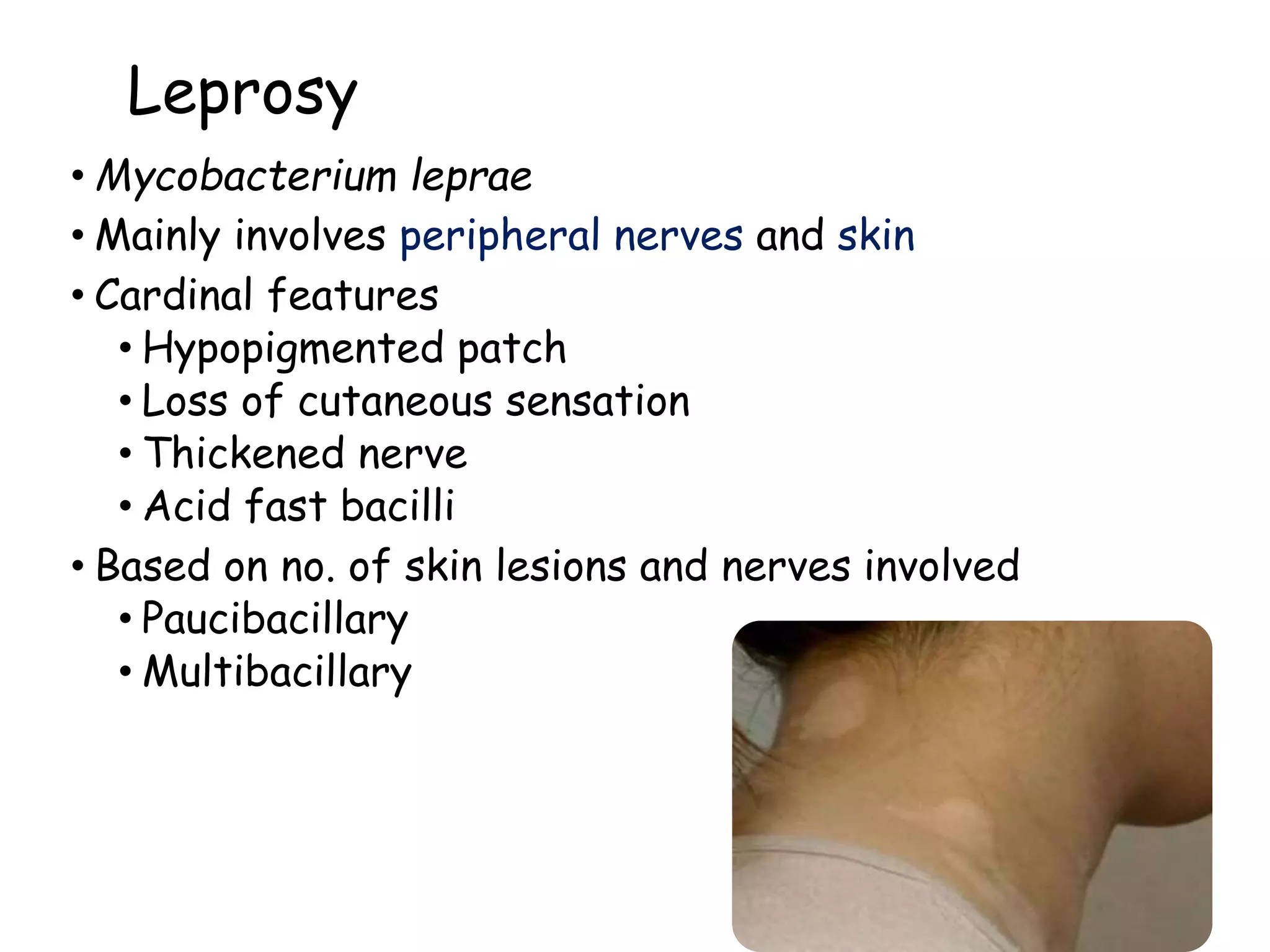 National leprosy eradication programme | PPTX