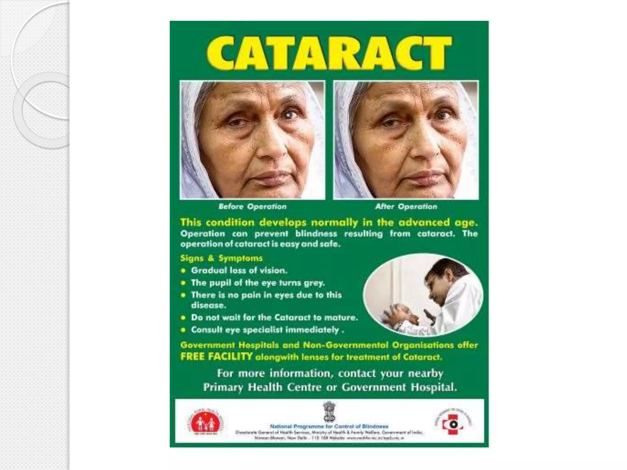 National programme for control of blindness and vision 2020 | PPTX