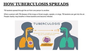 NATIONAL TUBERCULOSIS ELIMINATION PROGRAMME.pdf