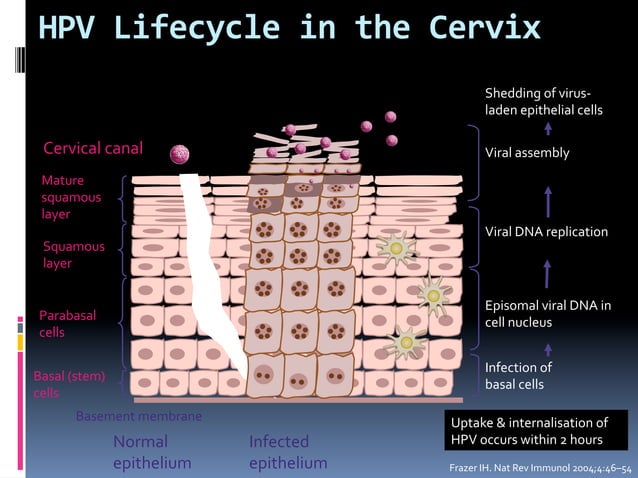 Natural history and pathogenesis of hpv | PDF