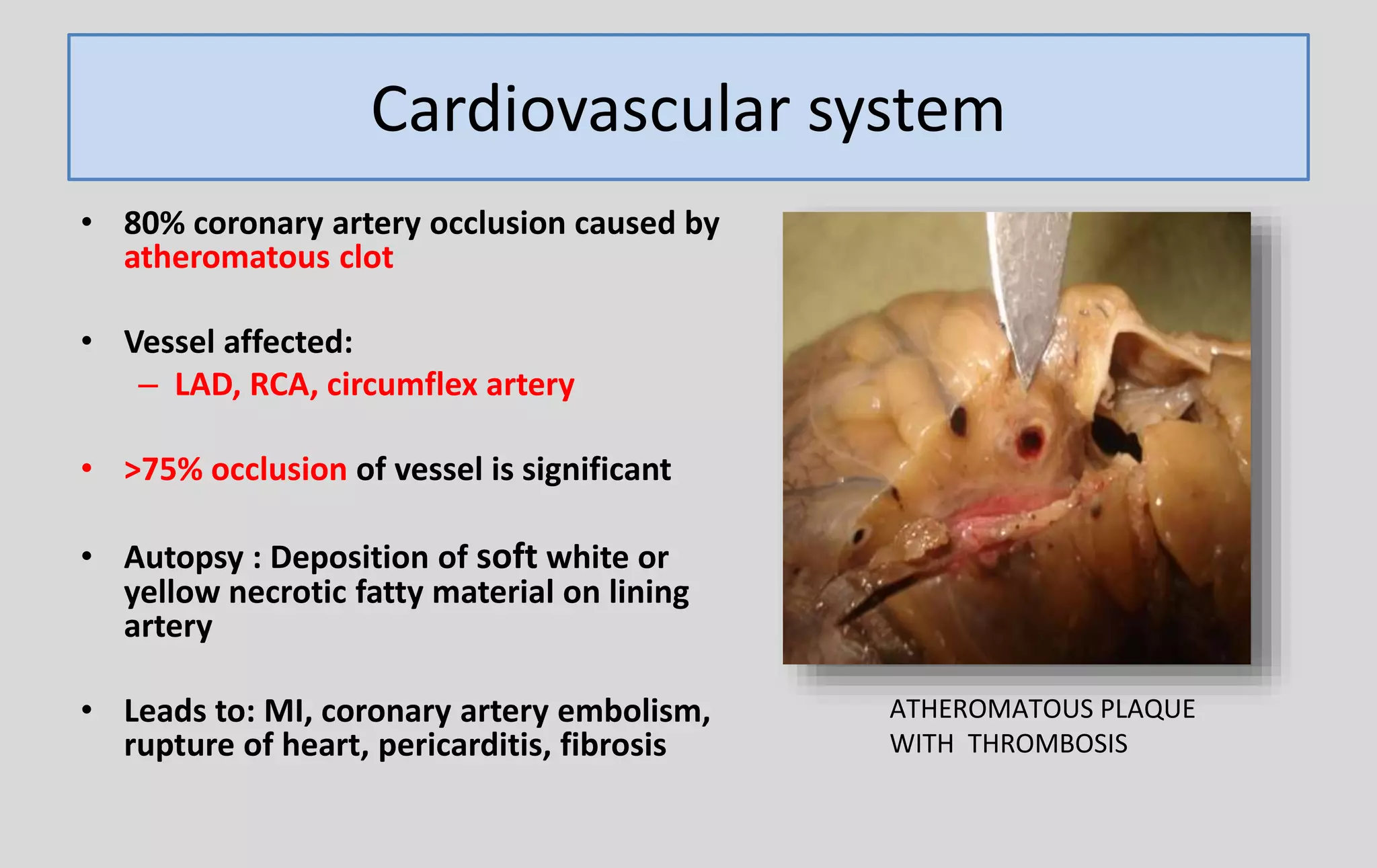 Natural death | PPTX