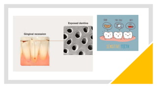 Natural Desensitizing agents.pptx
