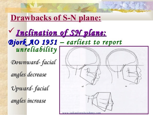 Natural head position /certified fixed orthodontic courses by Indian