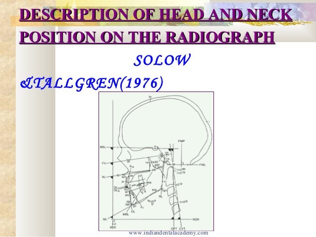 Natural head position /certified fixed orthodontic courses by Indian