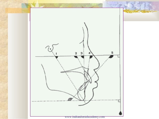 Natural head position /certified fixed orthodontic courses by Indian
