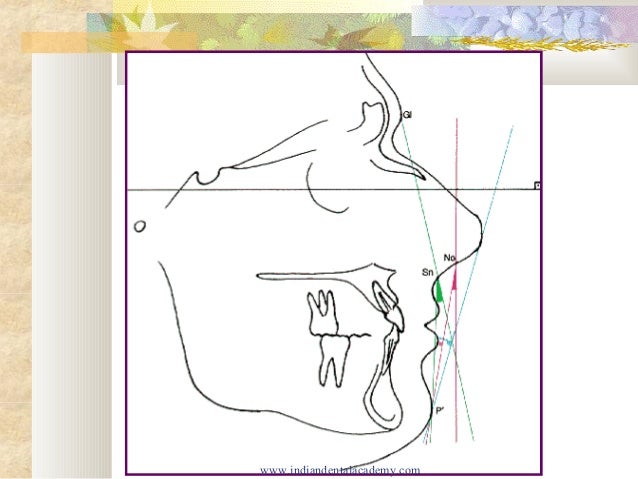 Natural head position /certified fixed orthodontic courses by Indian