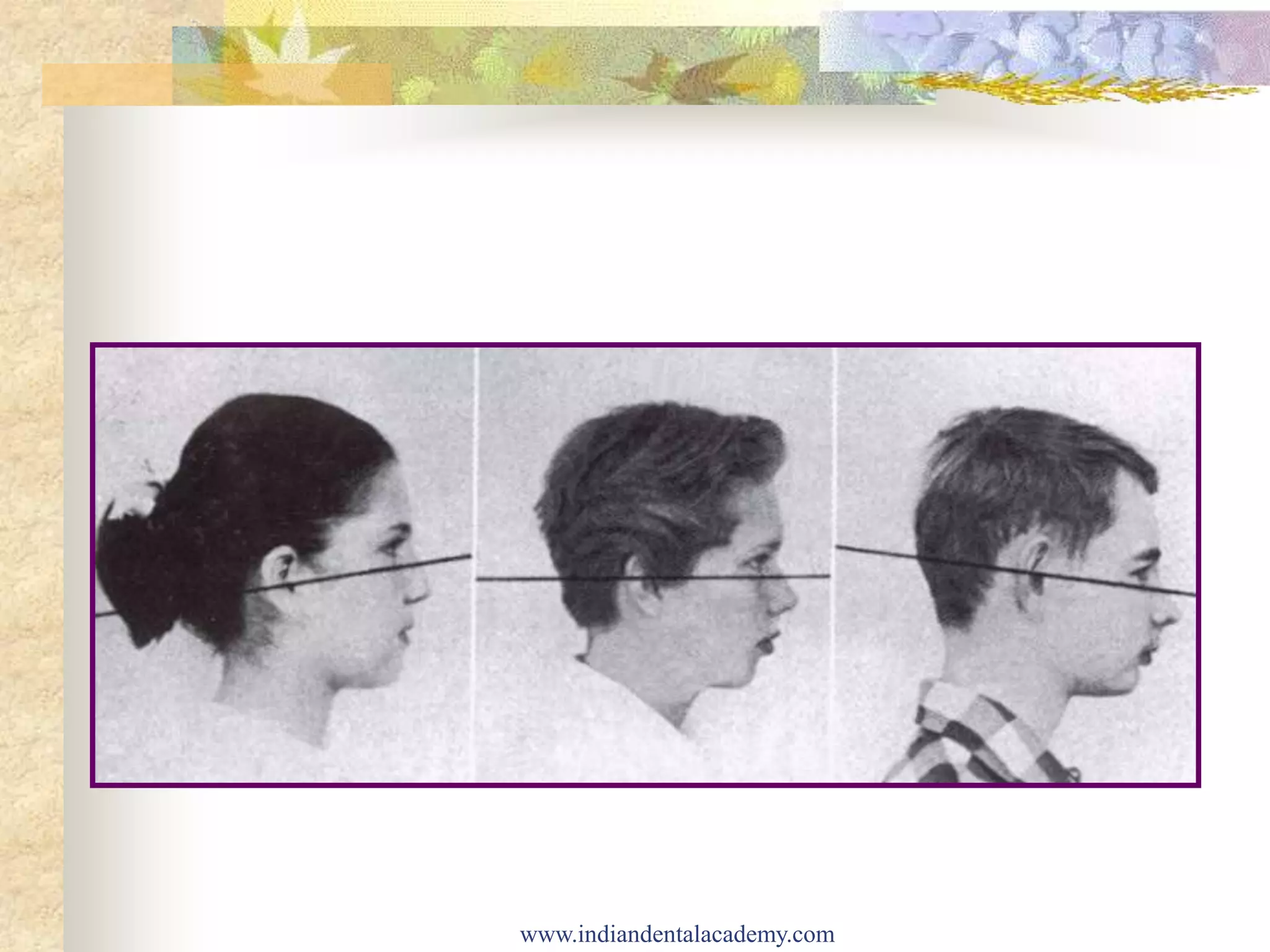 Natural head position | PPT