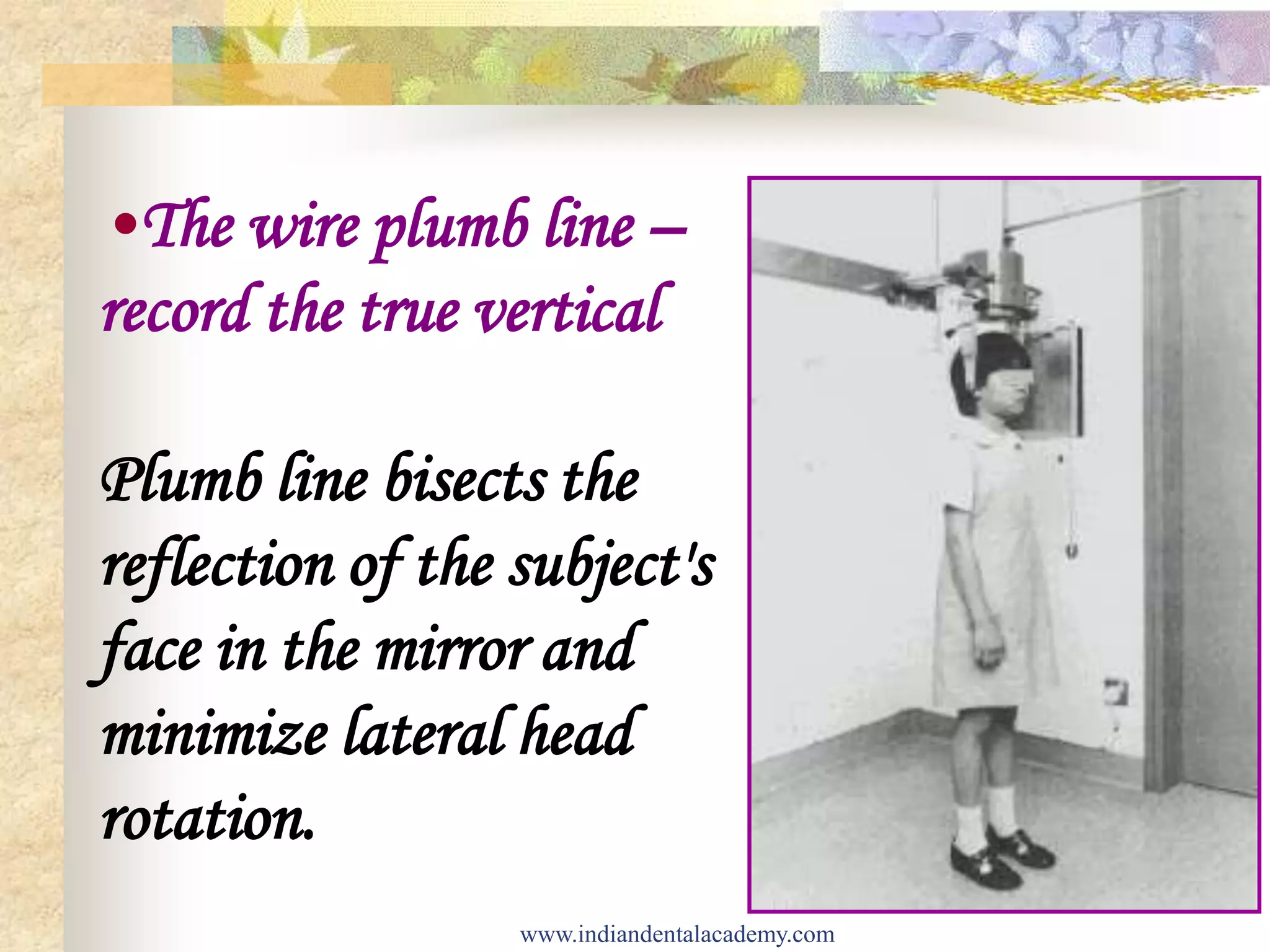 Natural head position | PPT