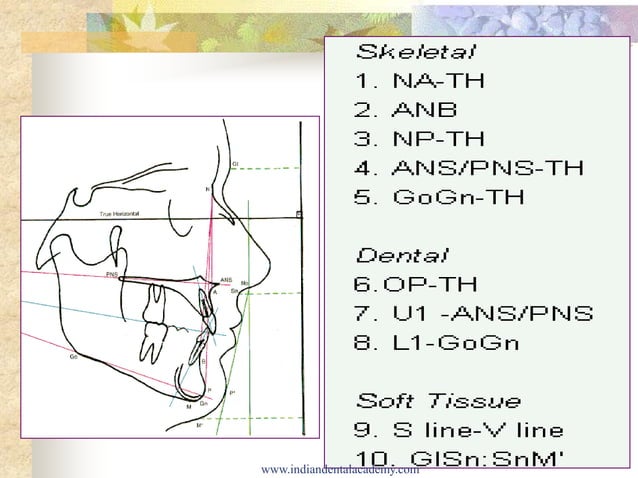 Natural head position