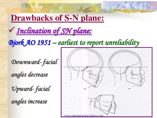 Natural head position