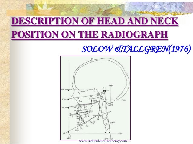 Natural head position