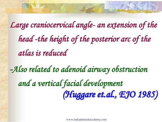 Natural head position