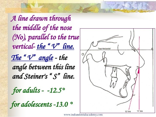 Natural head position