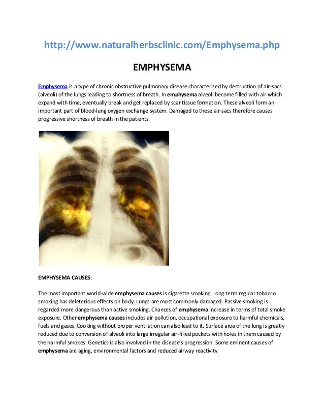 Emphysema Causes, Symptoms, Diagnosis, Treatment Emphysema Causes, Symptoms, Diagnosis, Treatment