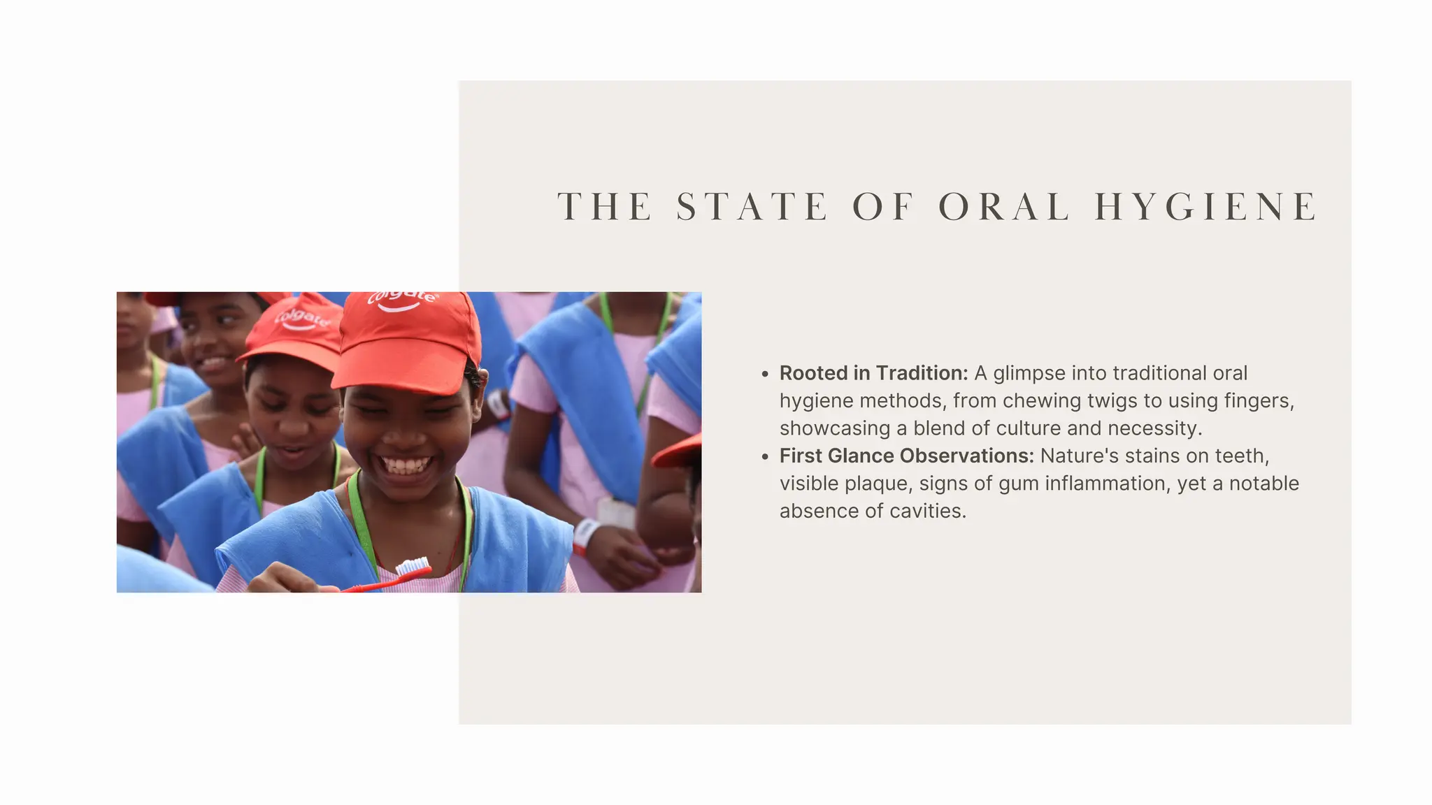 Natural history of periodontal disease in man.pdf