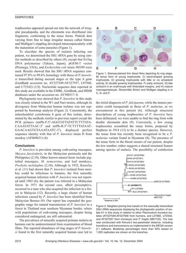Naturally acquired plasmodium knowlesi malaria in human, thailand[1] | PDF