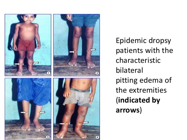 Natural pesticide & insecticides