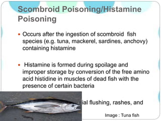 Natural toxic substances in food | PPTX