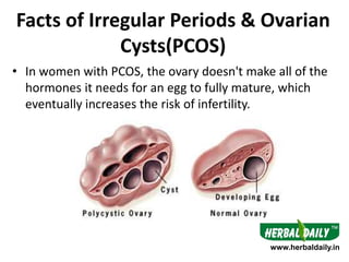 Natural treatment for irregular periods,overian cysts & pcos | PPTX