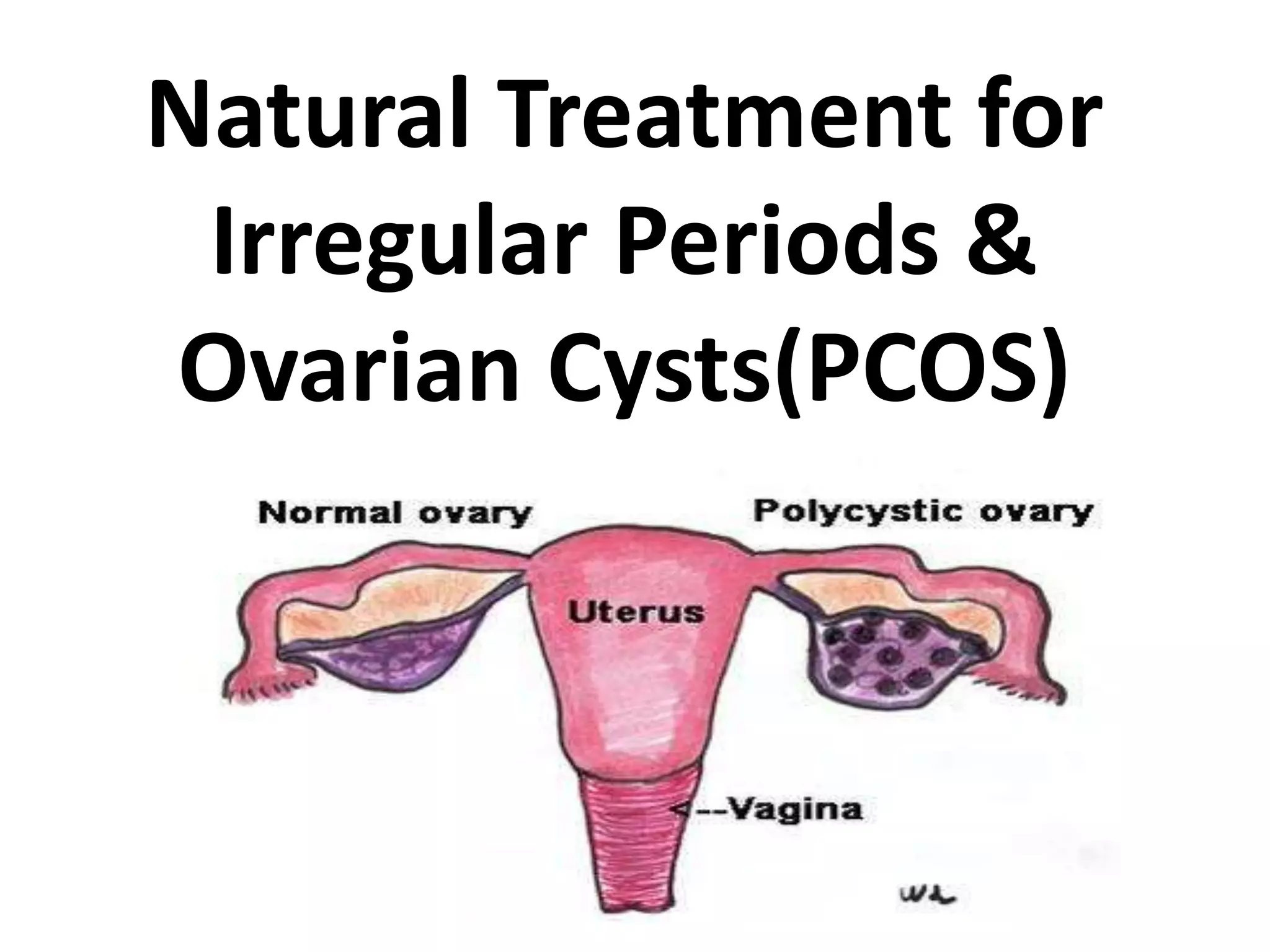 Natural treatment for Irregular Periods,Overian Cysts & Pcos in Hindi ...