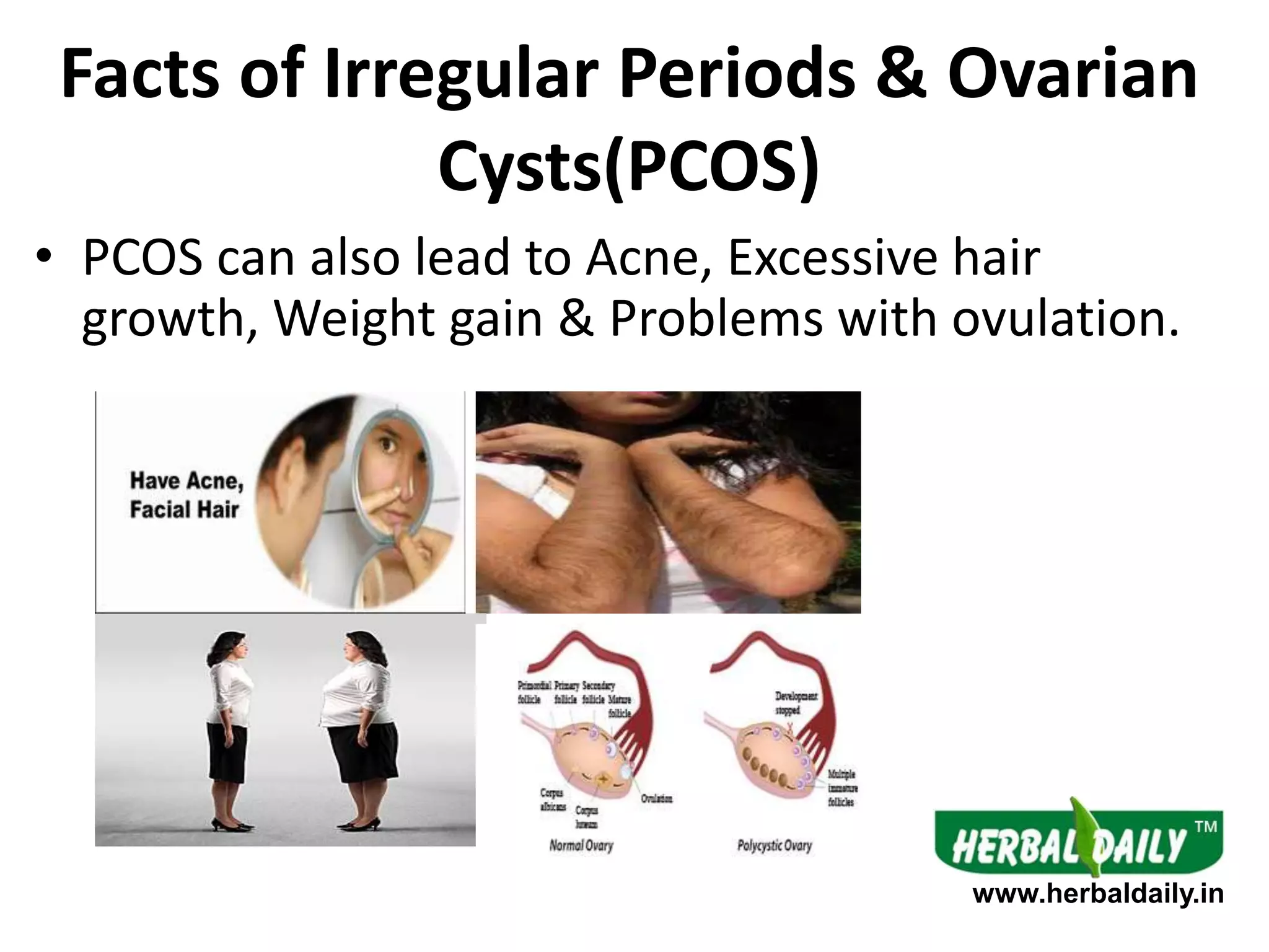 Natural treatment for Irregular Periods,Overian Cysts & Pcos in Hindi ...