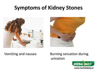 Natural treatment for kidney stones | PPTX