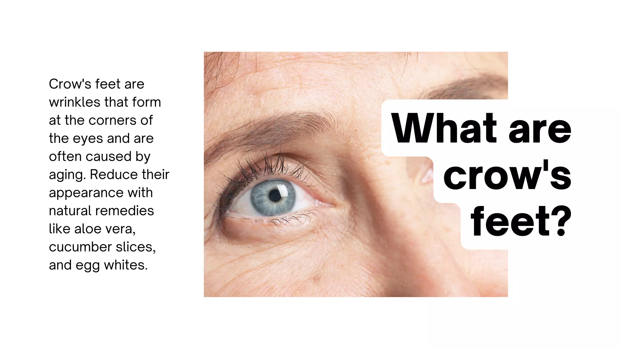 Natural Ways to Reduce Crow's Feet.pdf