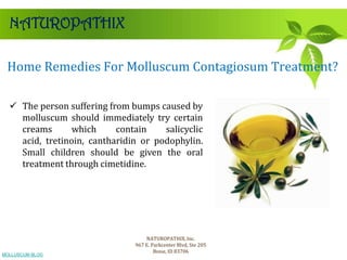 Molluscum Contagiosum Treatment Pptx