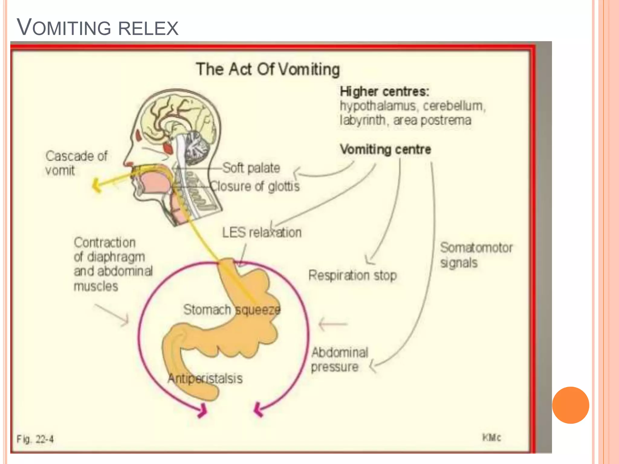 Nausea and vomiting | PPTX