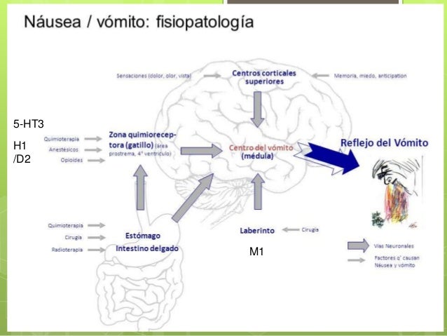 Nauseas y vomito