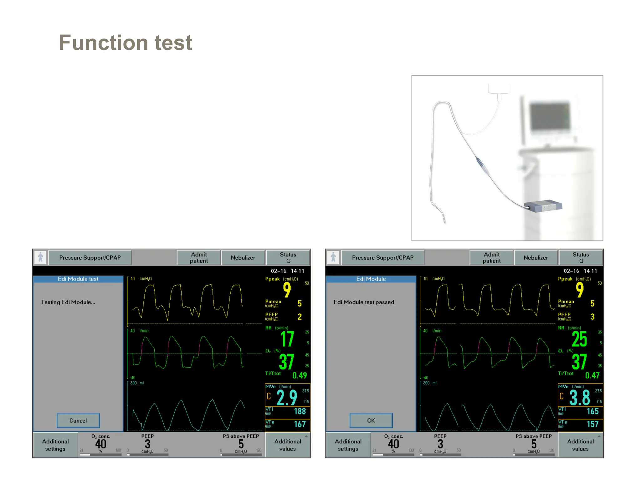 Getinge ventilation strategy using nava ventilation | PDF