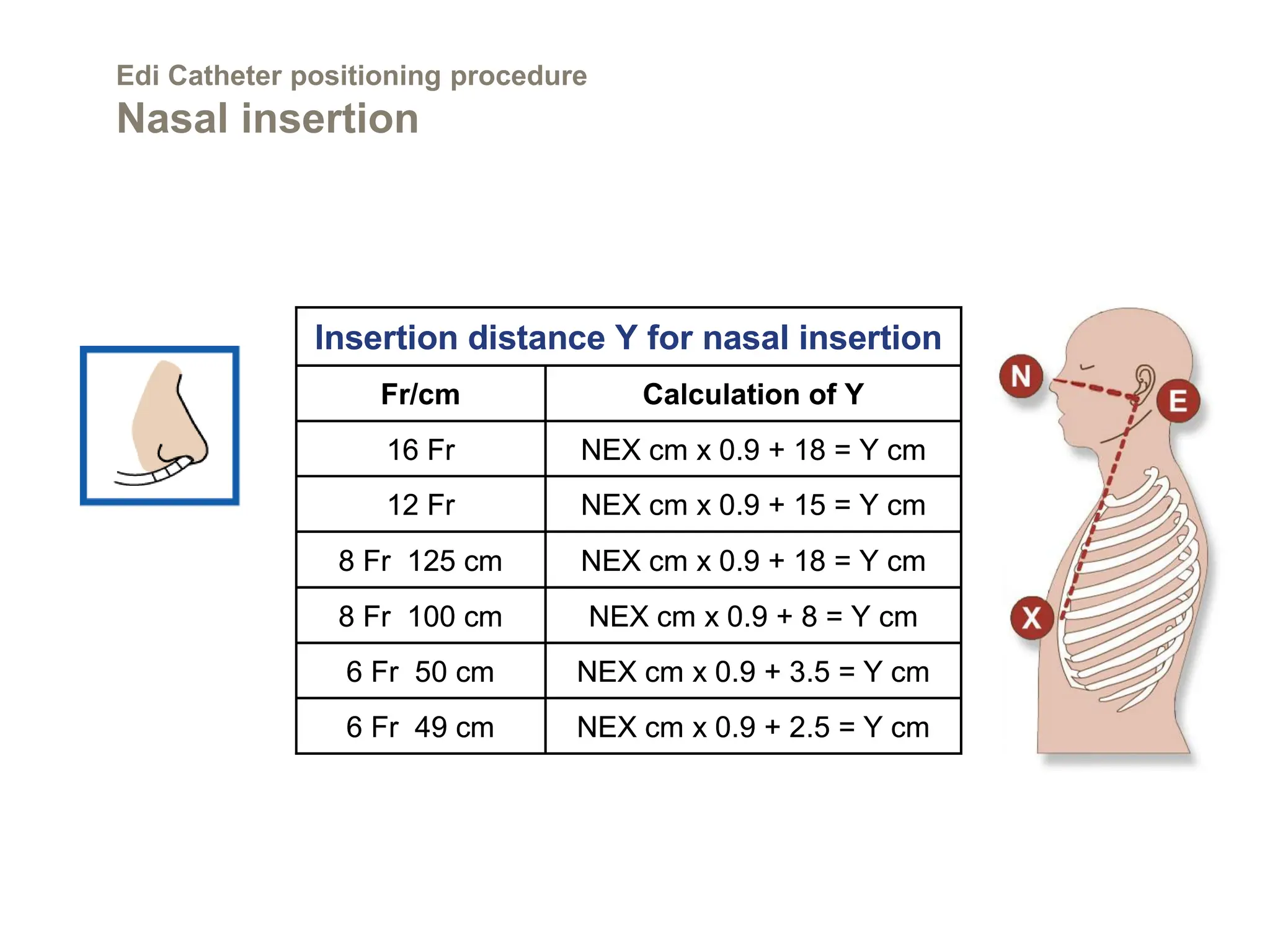 Getinge ventilation strategy using nava ventilation | PDF