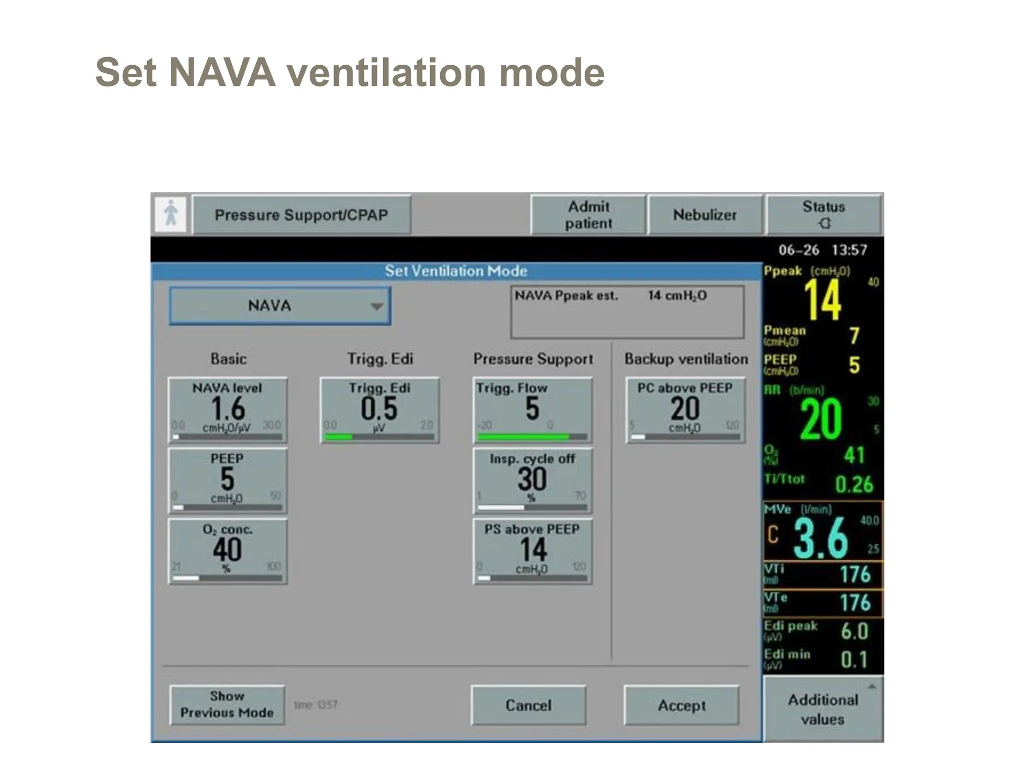 Getinge ventilation strategy using nava ventilation | PDF