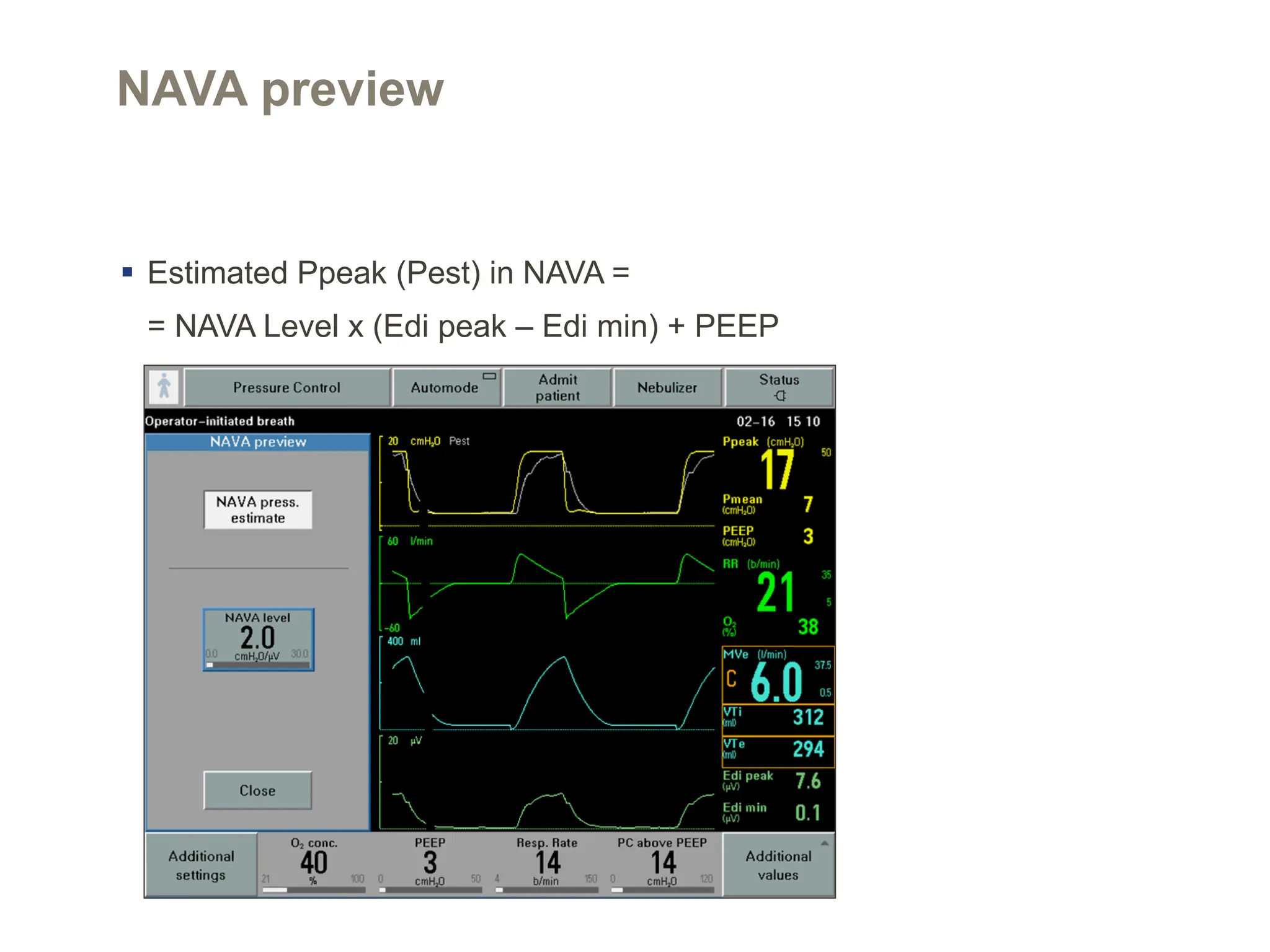 Getinge ventilation strategy using nava ventilation | PDF