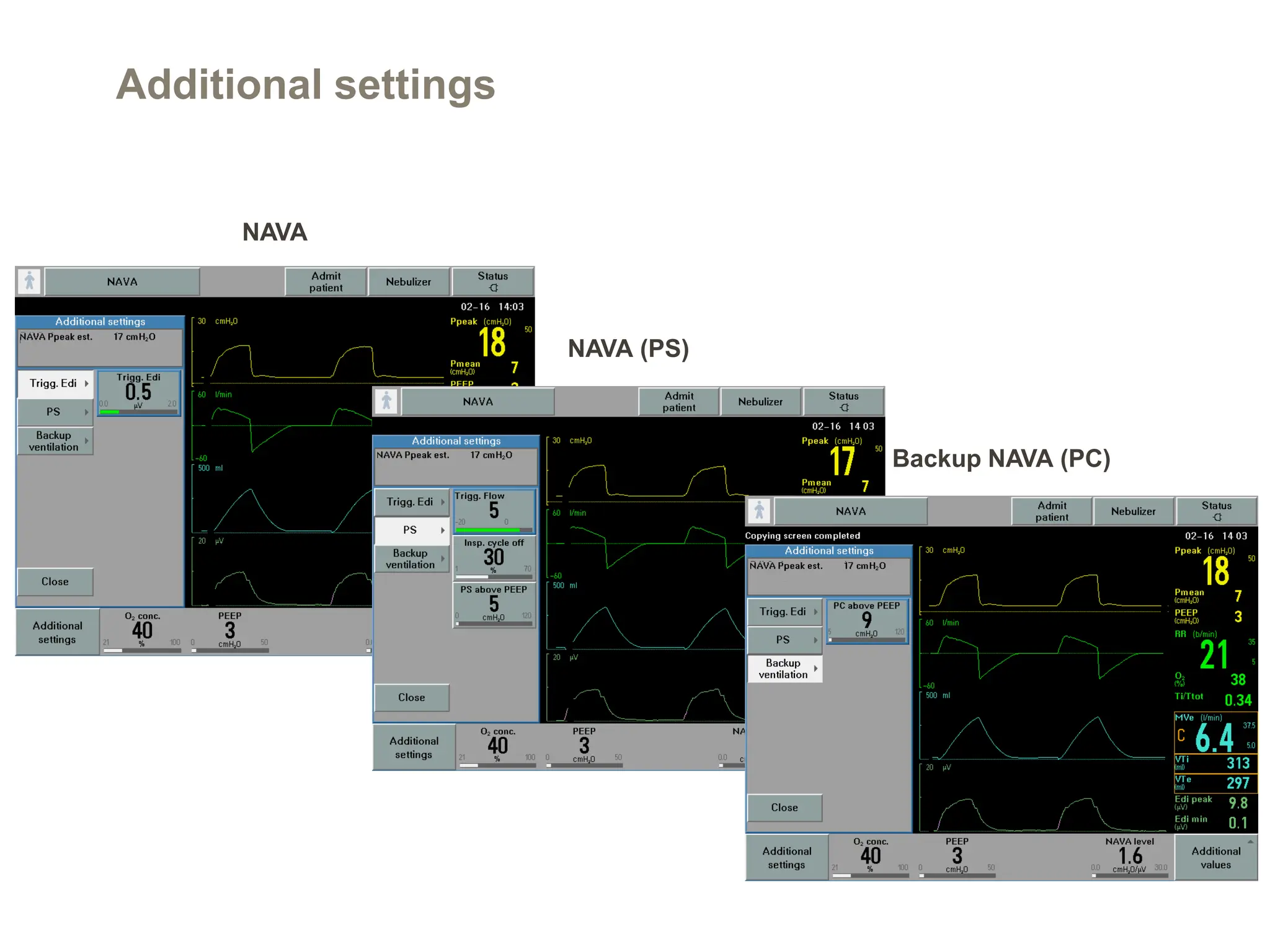Getinge ventilation strategy using nava ventilation | PDF