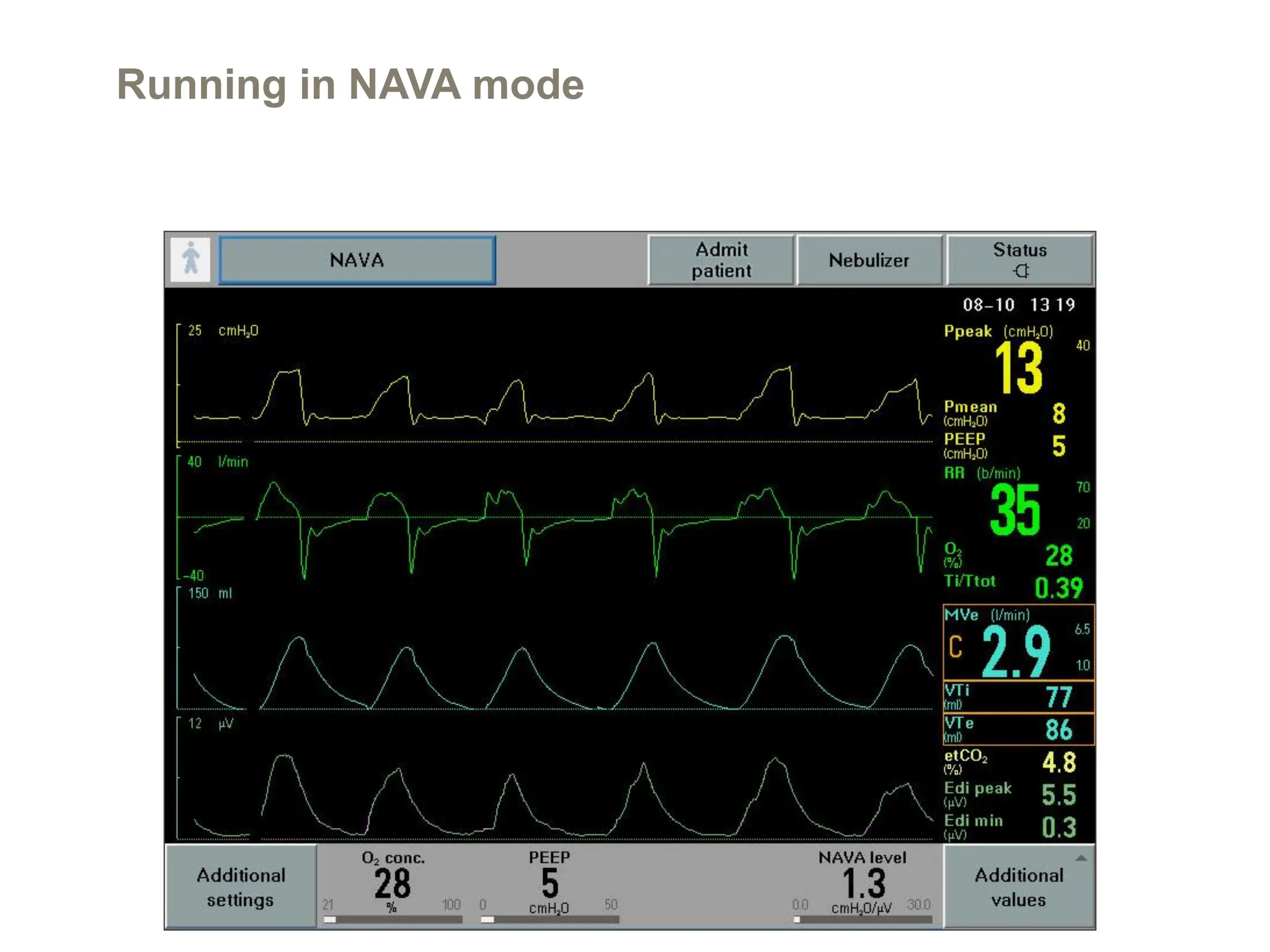 Getinge ventilation strategy using nava ventilation | PDF